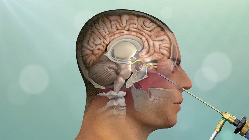 Types of Endoscopic Surgery - DHealthWellness - Everything About Health ...